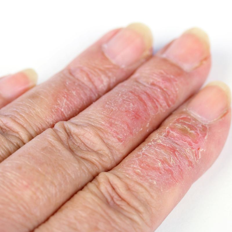 Vitaminen en mineralen | Voor onze dagelijkse gezondheid | Boots ...